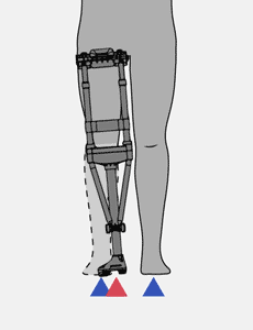 Our Guide to Fitting the iWalk 3.0 | Health and Care