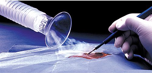 Schuco Acu-Evac IE II Surgical Smoke Evacuator - Complete System ...