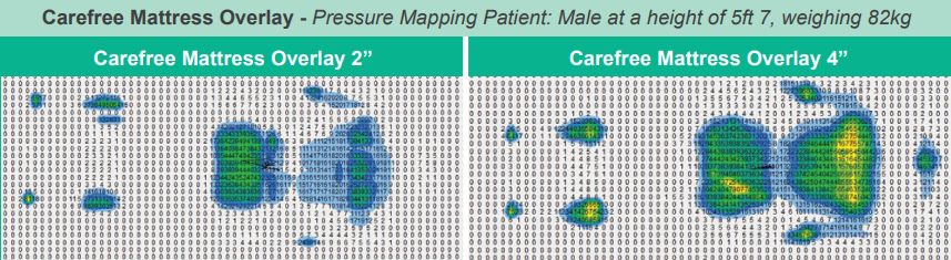 Modular Pressure Overlay Mattress | Health and Care