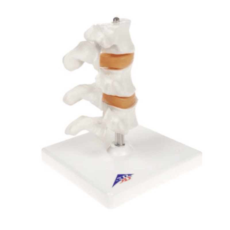 Spine Models | Health and Care