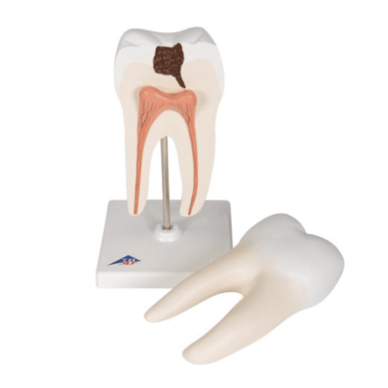 Dental Models | Health and Care