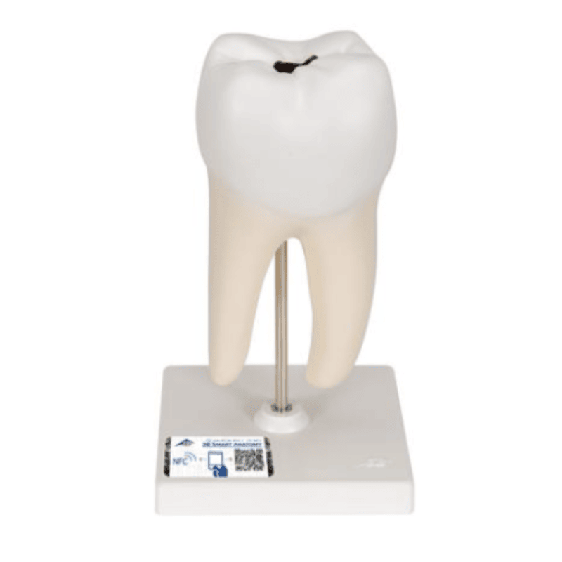 Anatomical Two-Part Human Molar Model | Health and Care