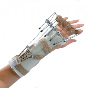 Dynamic Splinting | Health and Care