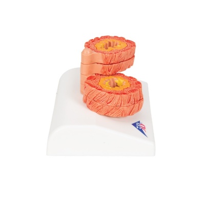 Lung Models | Health and Care