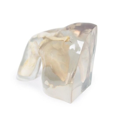 Erler-Zimmer X-ray Phantom Shoulder Model | Health and Care