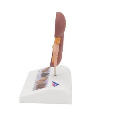 Urology Models | Health and Care