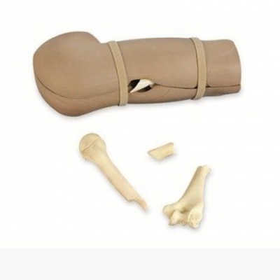 Life/Form Imaging Fracture Simulator | Health and Care