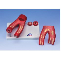 Heart & Circulatory Models | Health and Care