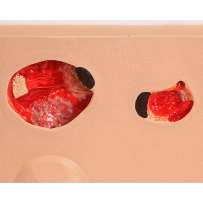 Prolevo FootSafe Pressure Ulcer Boots | Health and Care