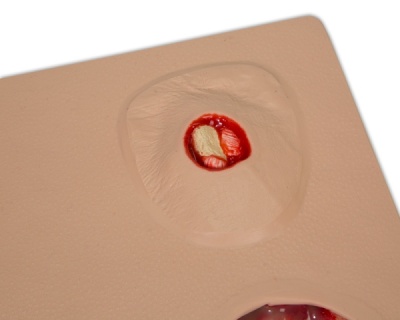 Prolevo FootSafe Pressure Ulcer Boots | Health and Care