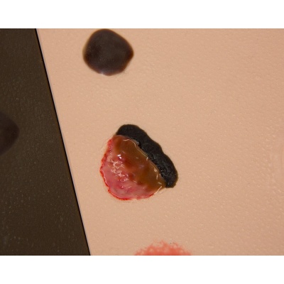 Prolevo FootSafe Pressure Ulcer Boots | Health and Care