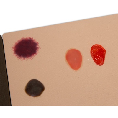 Prolevo FootSafe Pressure Ulcer Boots | Health and Care