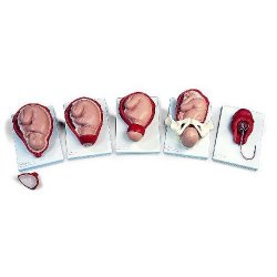 Birthing Process 5 Stages | Health and Care