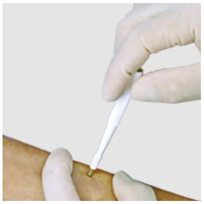 Acuderm Acu-Punch 5mm Skin Punches (10pk) | Health and Care