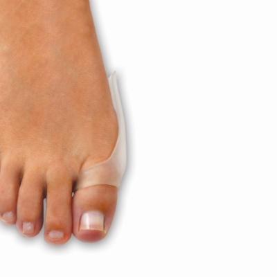 Bunion Treatment | Health and Care