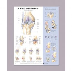 Anatomical Chart for Knee Injuries | Health and Care