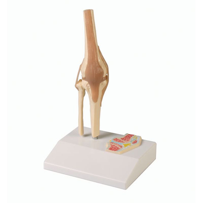 Miniature Knee Joint with Cross-Section | Health and Care