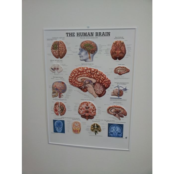 3D Human Brain Poster | Health and Care