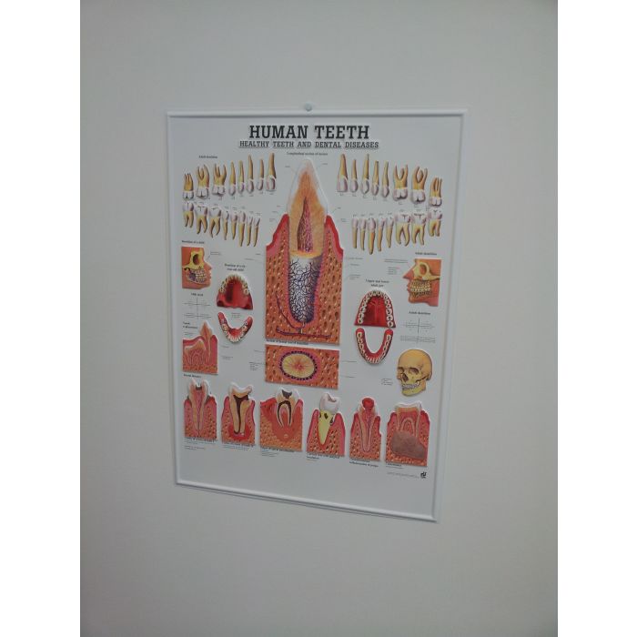 3D Human Teeth Poster | Health and Care