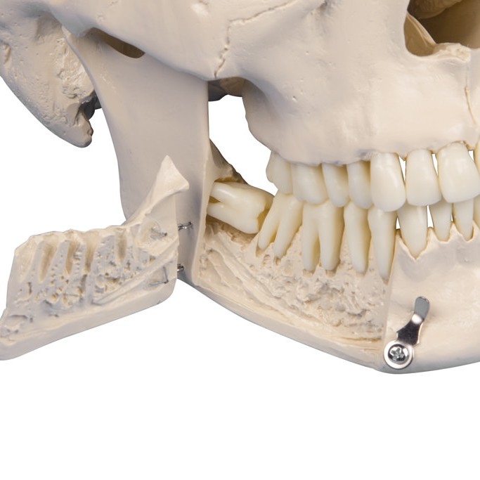 4-Part Dental Skull | Health and Care