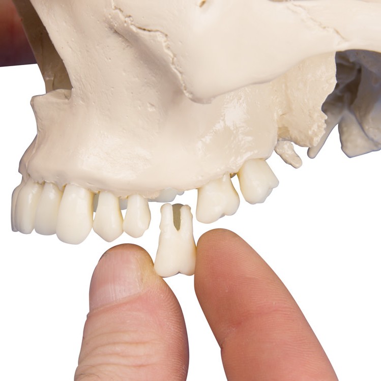 4-Part Dental Skull | Health and Care