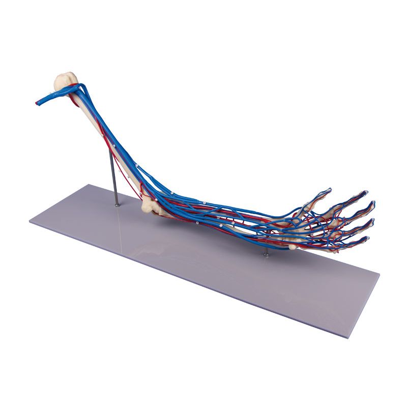 Vascular Arm Model | Health and Care