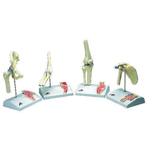 Mini Knee Joint With Cross Section | Health and Care