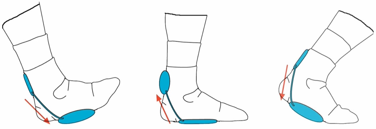 Aircast AirHeel Plantar Fasciitis Ankle Brace | Health and Care