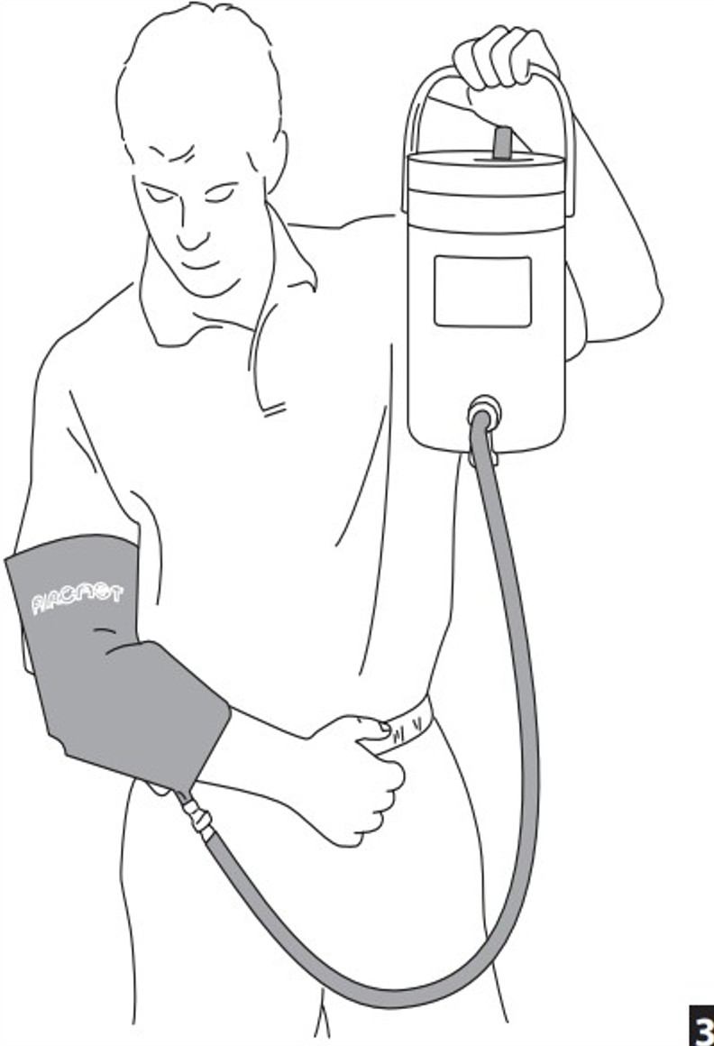 Aircast Elbow Cold Therapy Cryo/Cuff | Health and Care