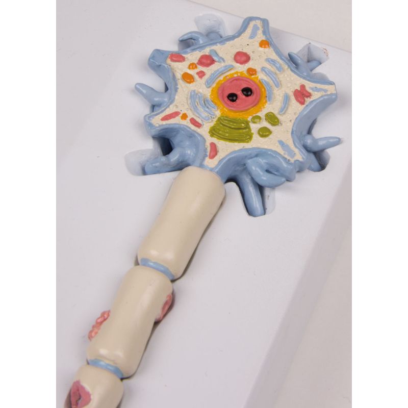 Multiple Sclerosis Neuron Model | Health and Care