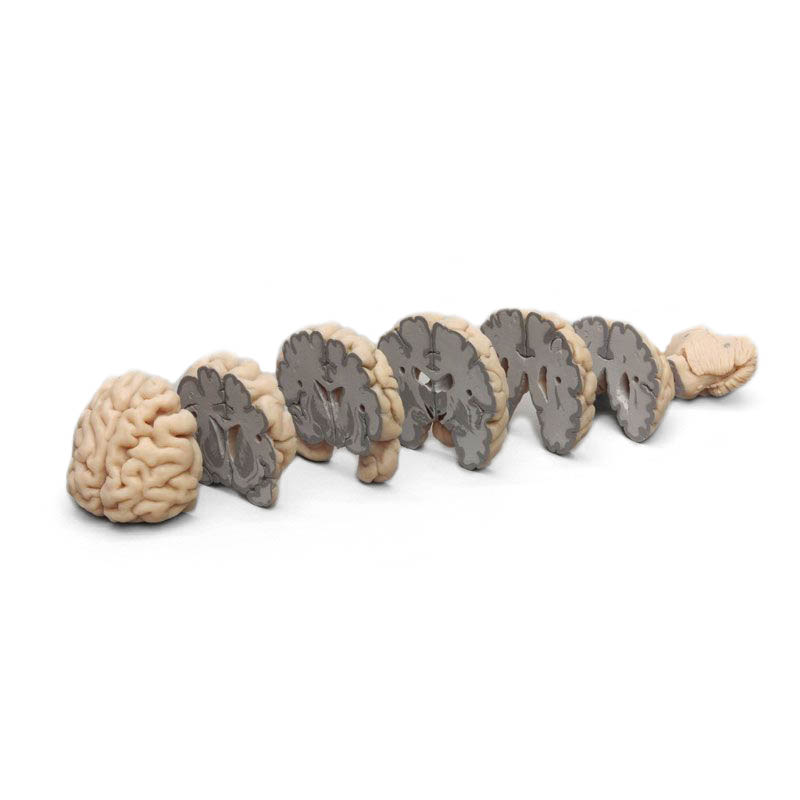 Human Brain Multiple Frontal Sections | Health and Care