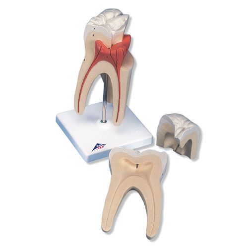 Upper Triple-Root Molar 3 Part | Health and Care