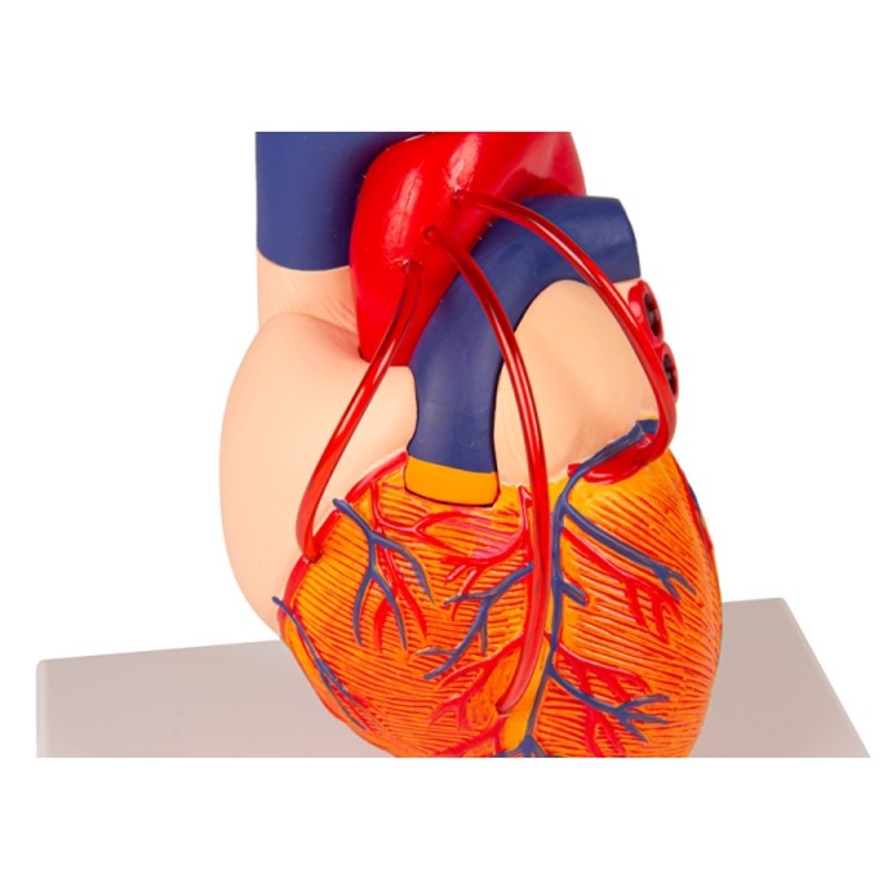 Heart Bypass Model | Health and Care