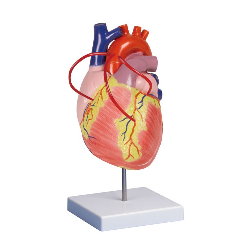 Enlarged Heart Bypass Model | Health and Care