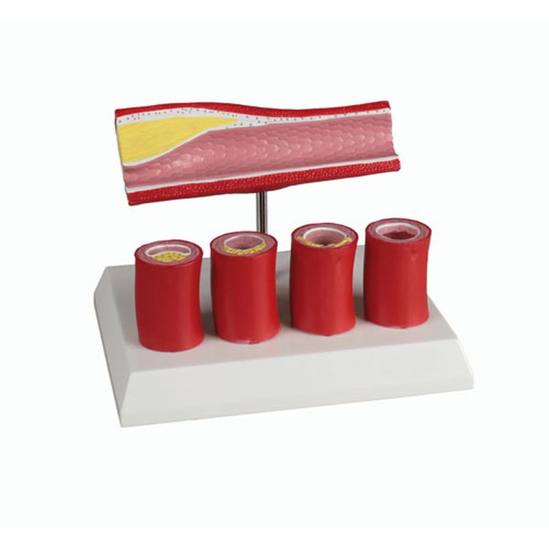 Artery Model with Sections | Health and Care