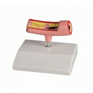 Detailed Model Artery | Health and Care
