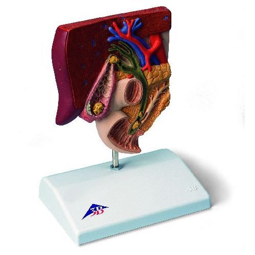 Gallstone Model | Health and Care