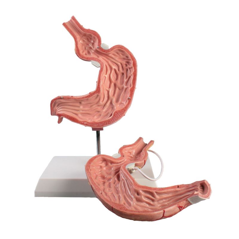 Gastric Band Stomach Model | Health and Care