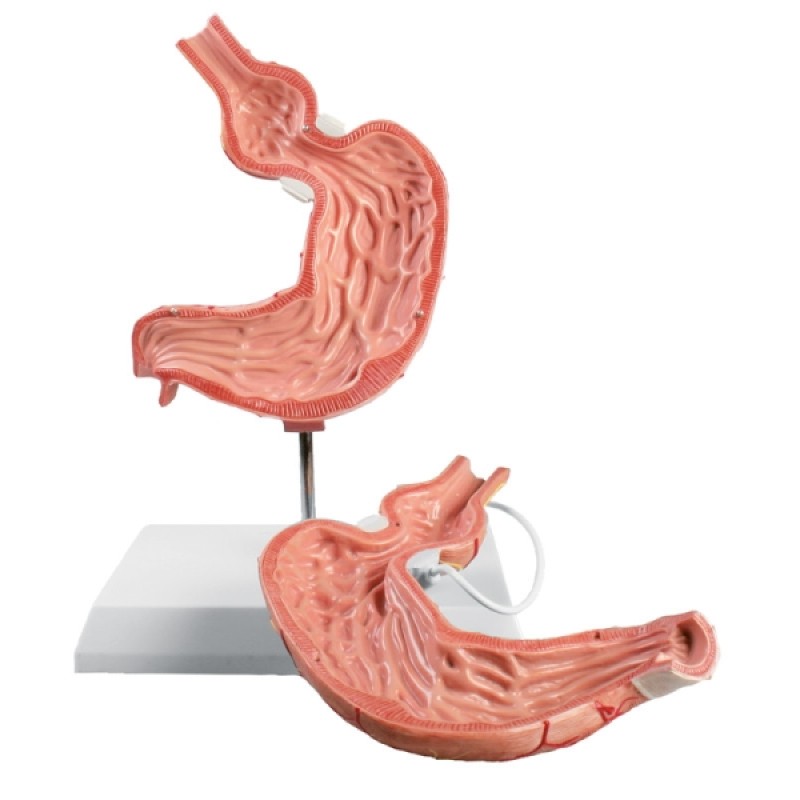 Anatomical Model of Stomach with Gastric Band | Health and Care