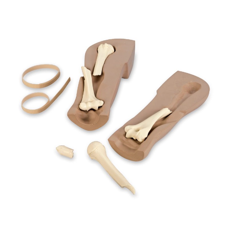 Life/Form Imaging Fracture Simulator | Health and Care