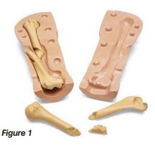 Life/Form Imaging Fracture Simulator | Health and Care