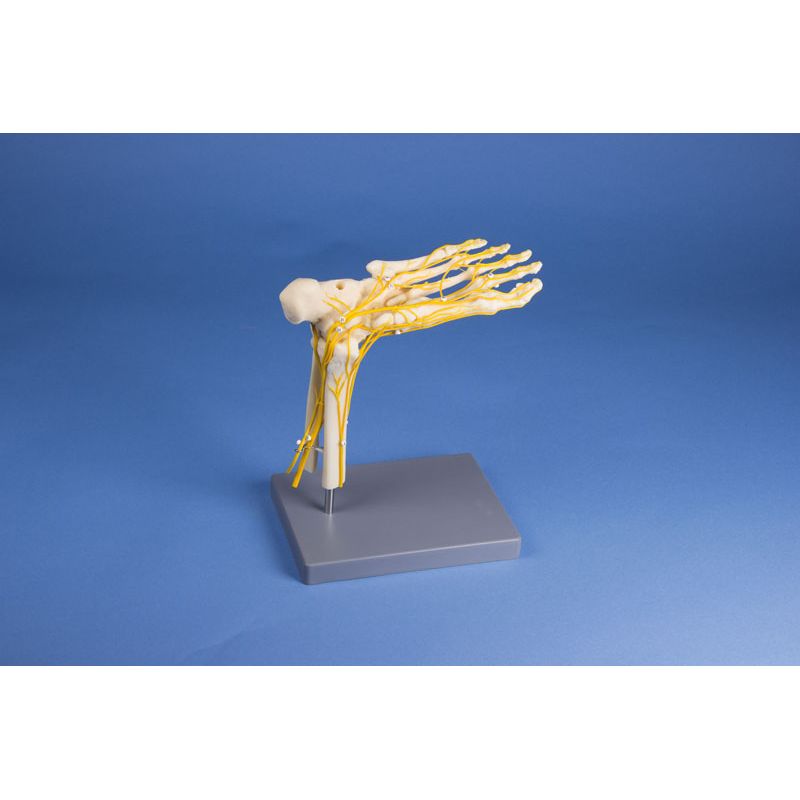 Neuro Foot Model | Health and Care