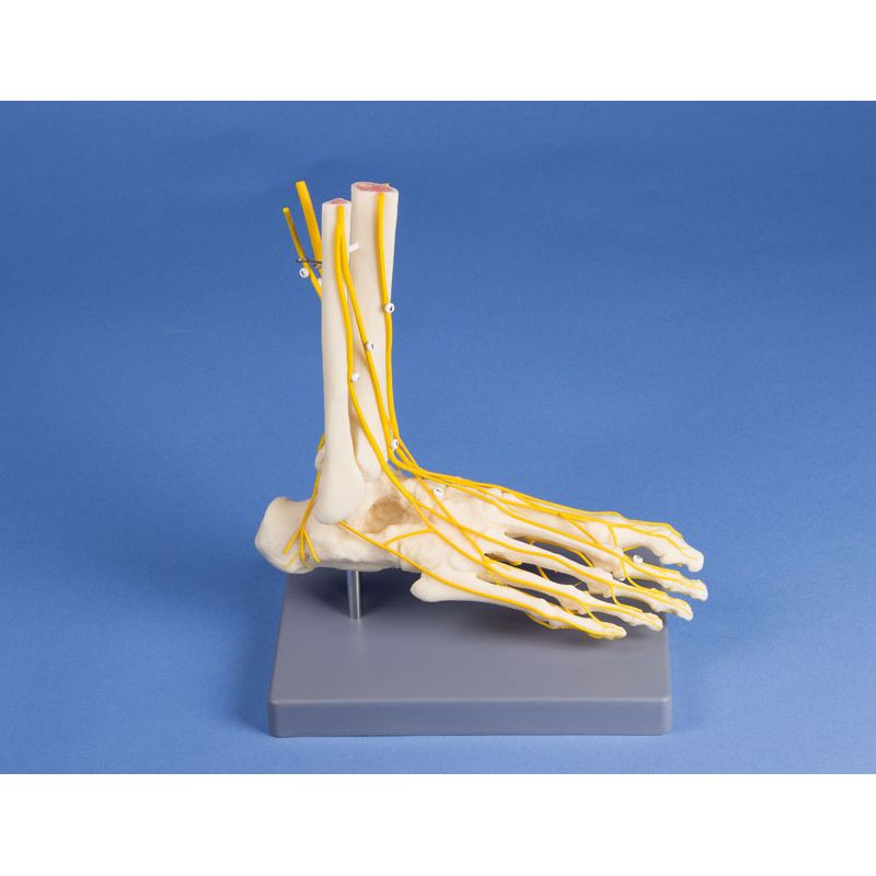 Neuro Foot Model | Health and Care
