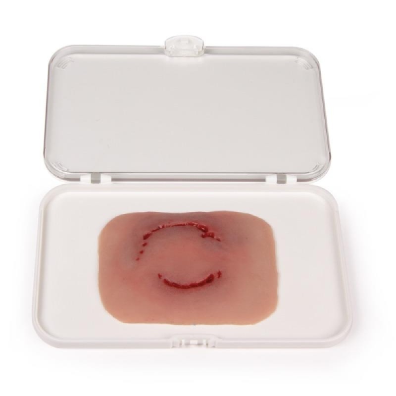 Erler Zimmer Wound Moulage Human Bite Wound | Health and Care