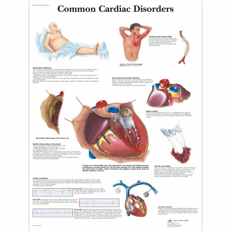 3B Common Cardiac Disorder Pathology Chart | Health and Care