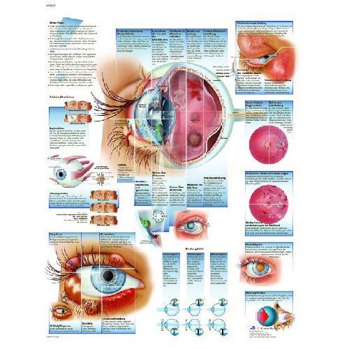 Diseases Of The Eye Chart | Health and Care
