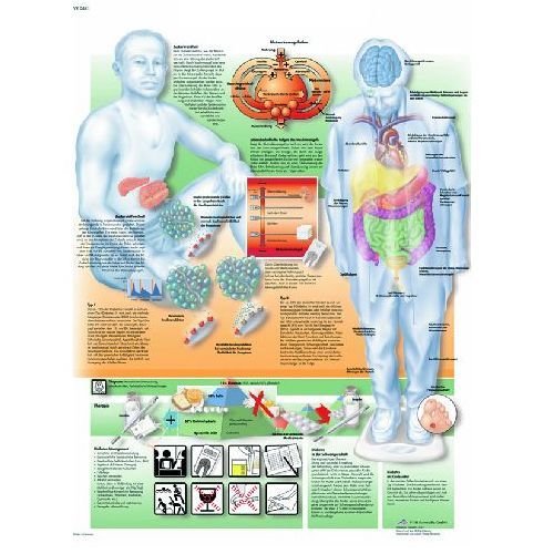 Diabetes Mellitus Chart | Health and Care