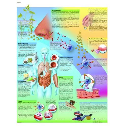 Allergies Chart | Health and Care