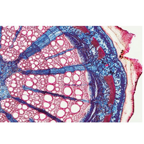 Angiospermae Iv. Stems - English Slides | Health and Care