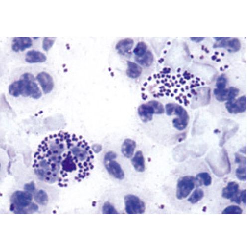 Pathogenic Bacteria - English Slides | Health and Care